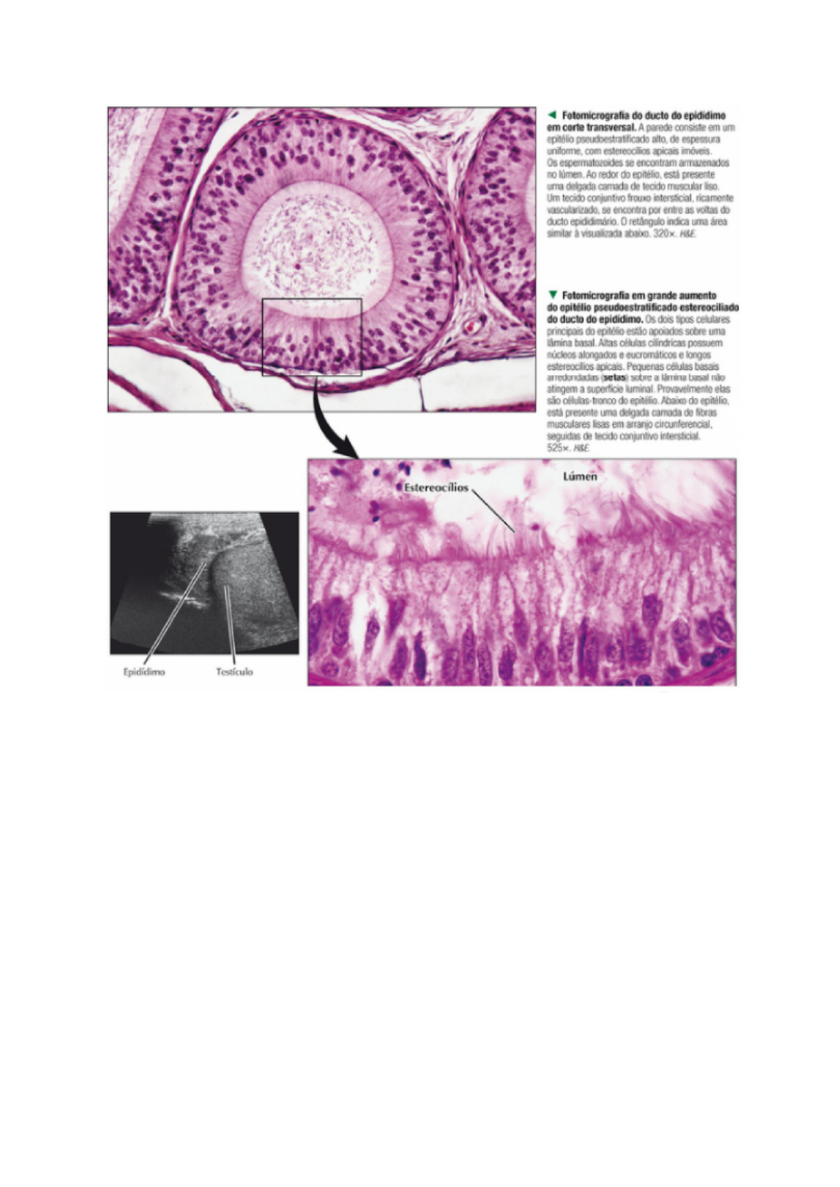 Histologia Do Ducto Epididimo SciELO Brasil Morfologia Do Escroto,