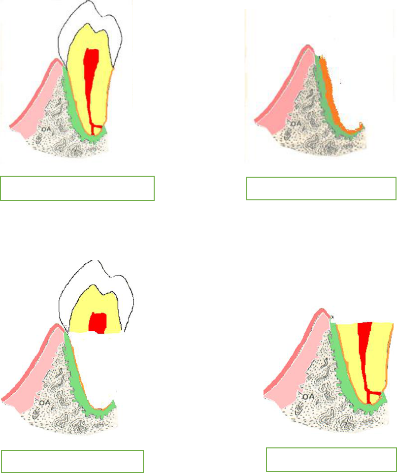 Aula - anatomia dental formatada - Anatomia e Escultura Dental