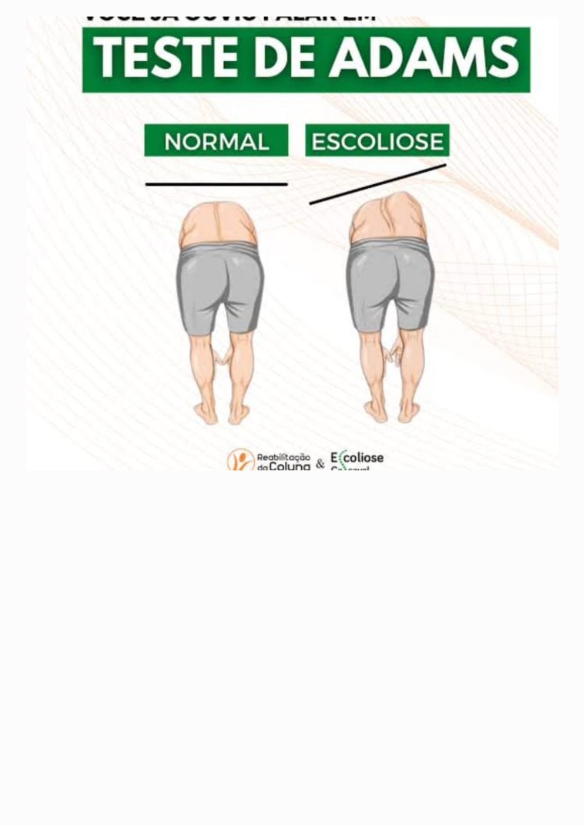 Teste de Adams 220510 235518 - Avaliação Cinético Funcional