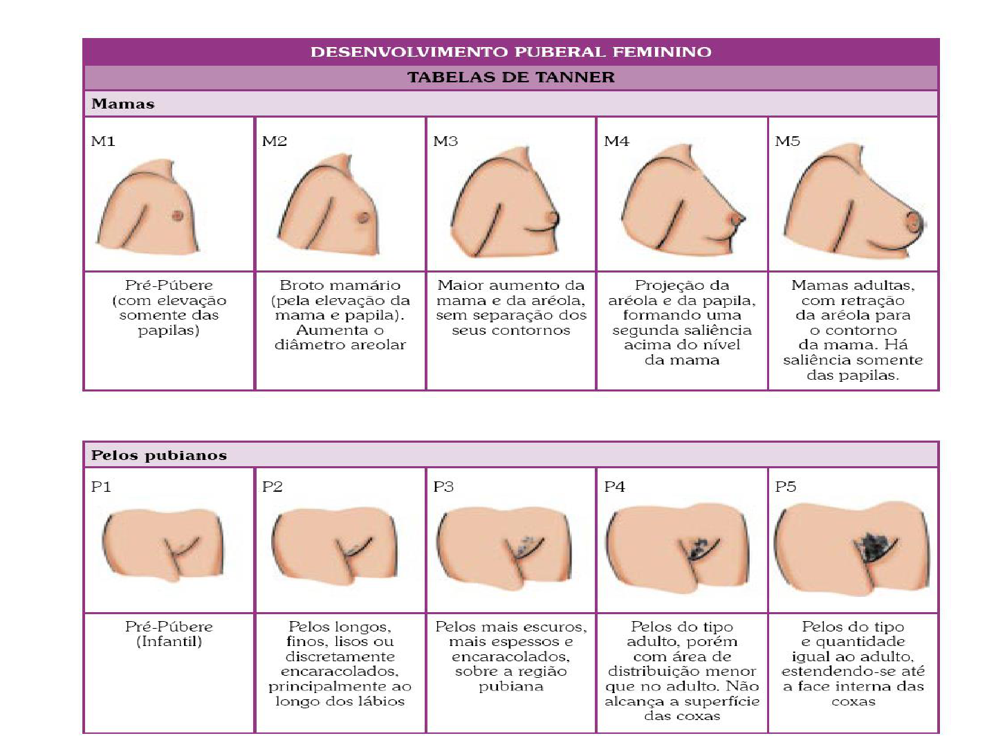 Meninas Puberdade Botoes Mamarios Puberdade Dr. João Ferro