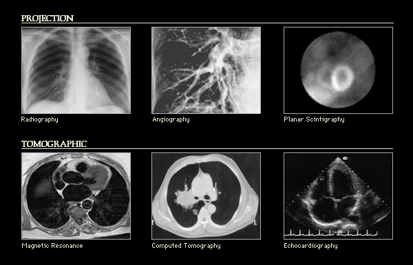 projection vs tomographic - Anatomia do Aparelho Locomotor