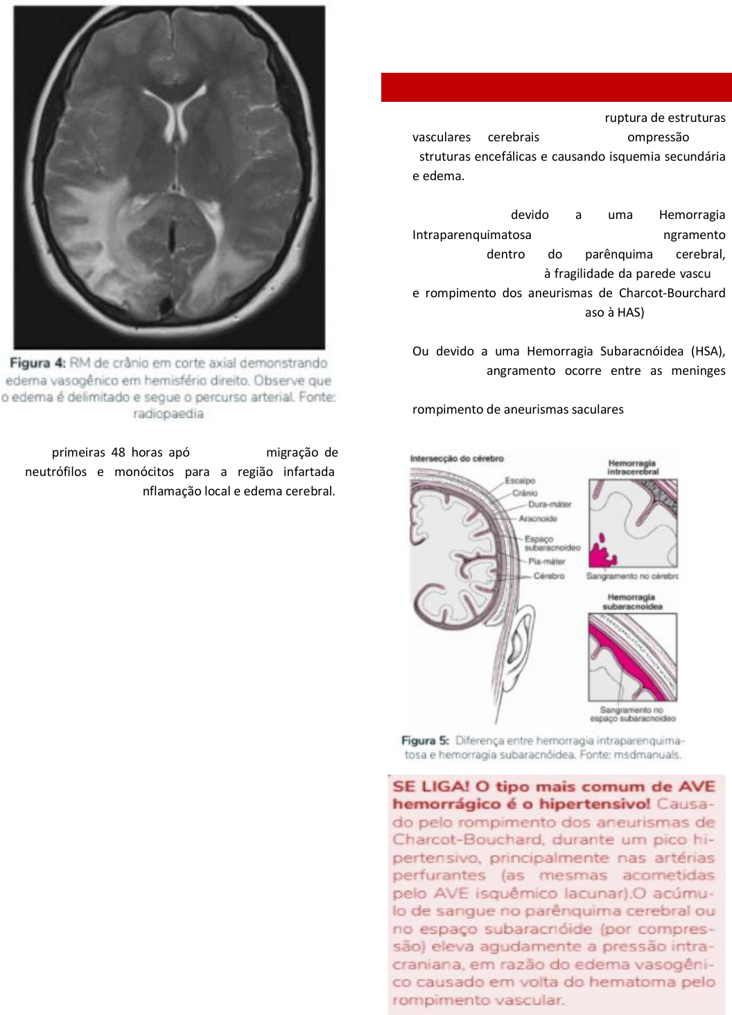 Anatomia Venosa Membro Inferior Radiopaedia Radiology - Infoupdate.org