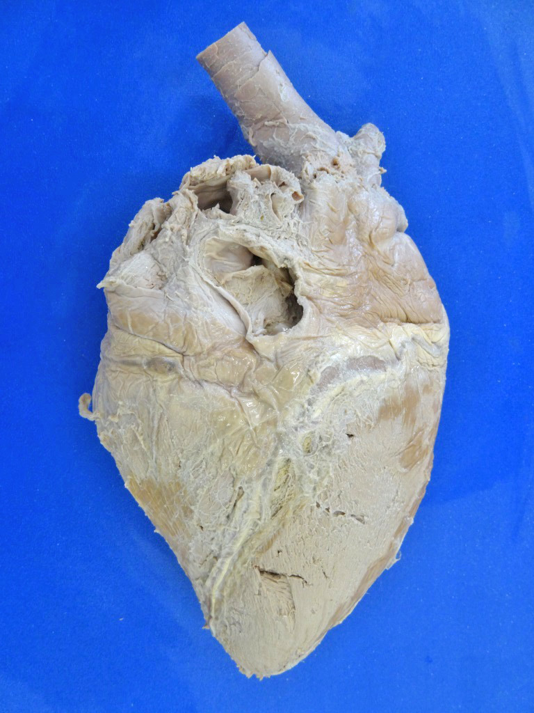 coracao equino (3) - Anatomia Veterinária I