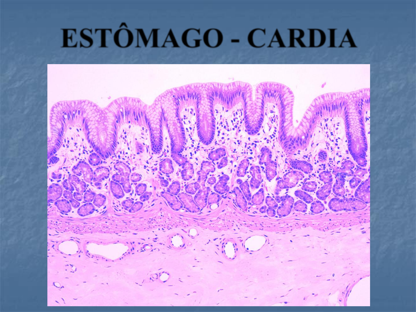 Histologia Do Estomago Humano Tecido Do Estômago Intestino Delgado