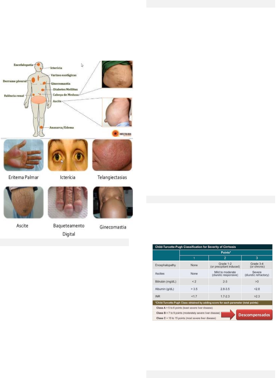 Hepatopatia Crônica E Cirrose - RETOEDU