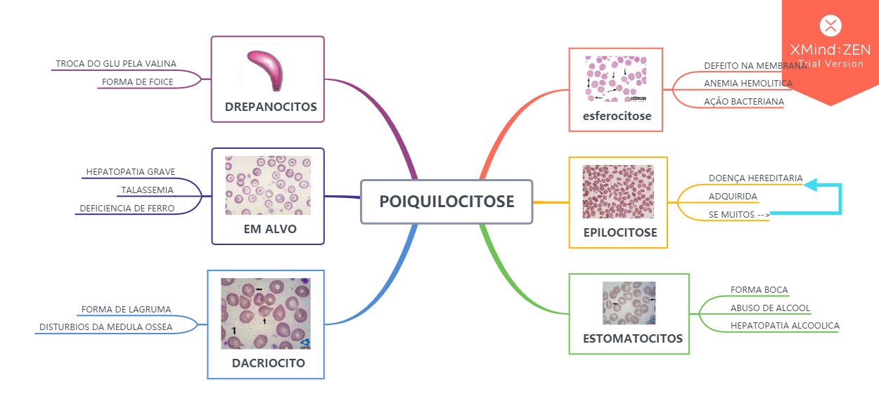 POIQUILOCITOSE - Biomedicina