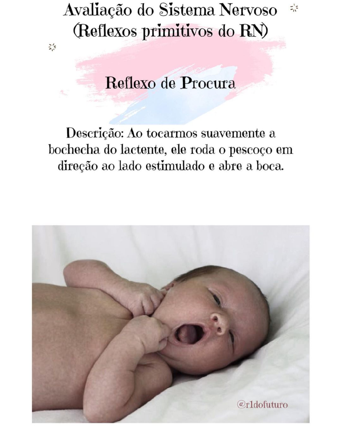 REFLEXOS PRIMITIVOS DO RN Pediatria I reflexos-primitivos-do-rn-pediatria-i