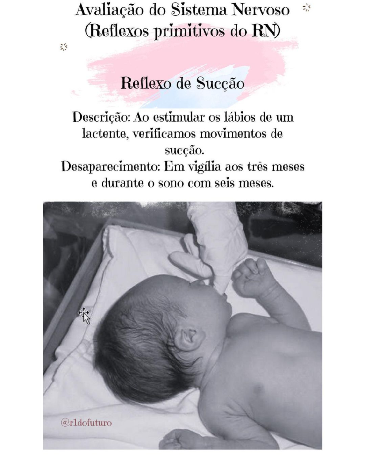 REFLEXOS PRIMITIVOS DO RN - Pediatria I