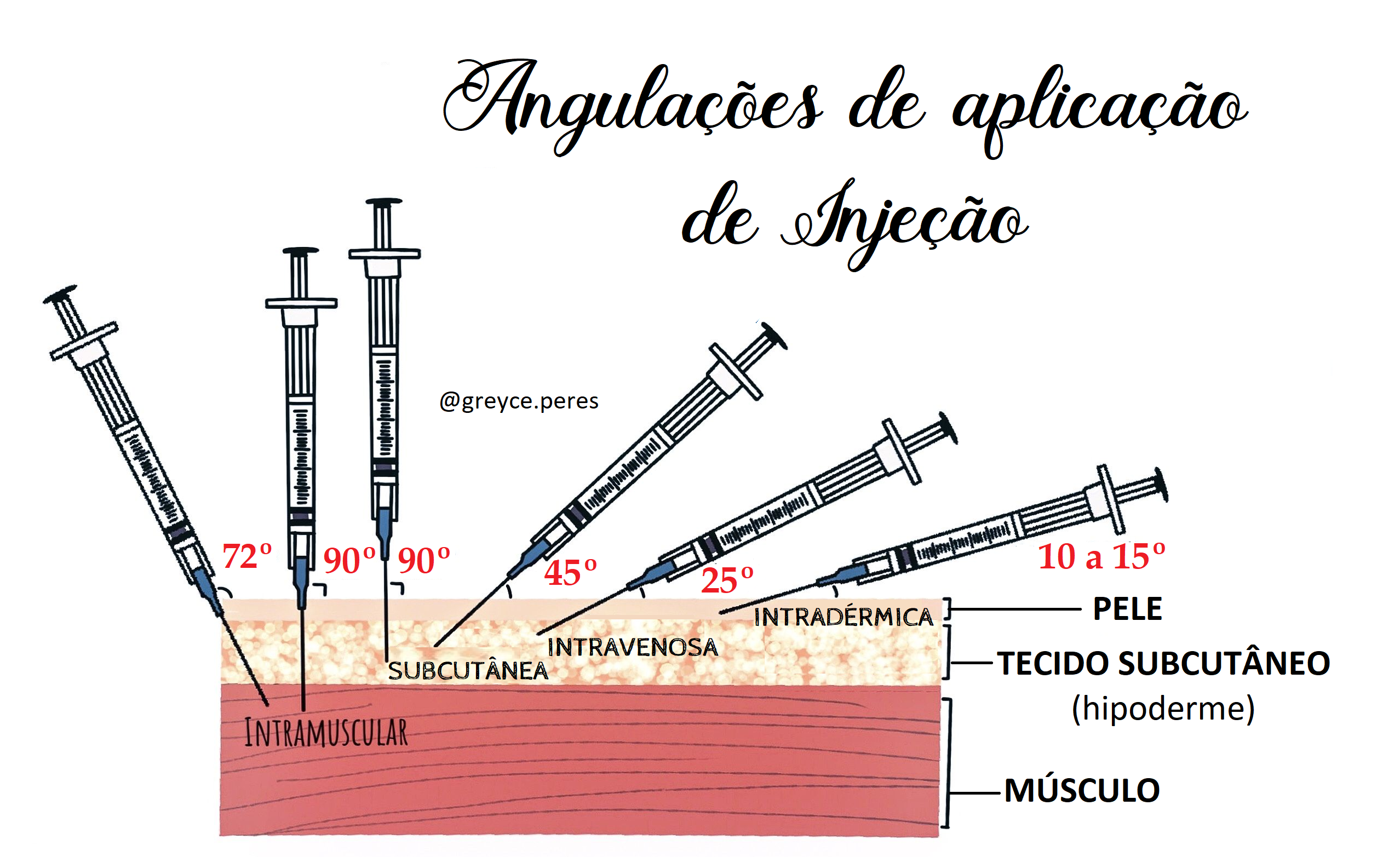 Angulações de aplicação de injeção - Farmacologia I