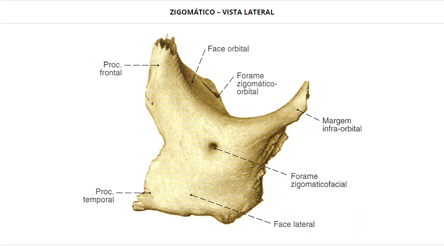 vista lateral osso zigomatico - Anatomia II