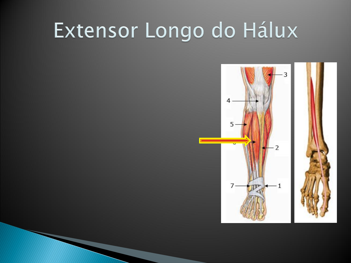 Extensor Curto Do Halux