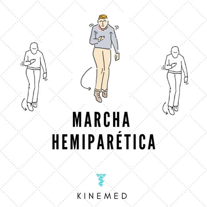 Tipos de marcha - Fisioterapia Neurofuncional
